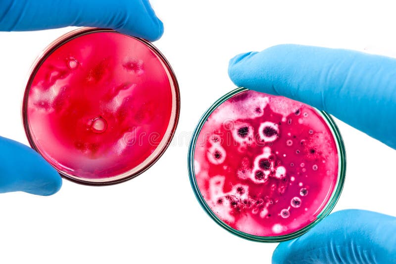 Doctor`s Hands Holds Petri Dish with Bacteria on White Background Stock ...