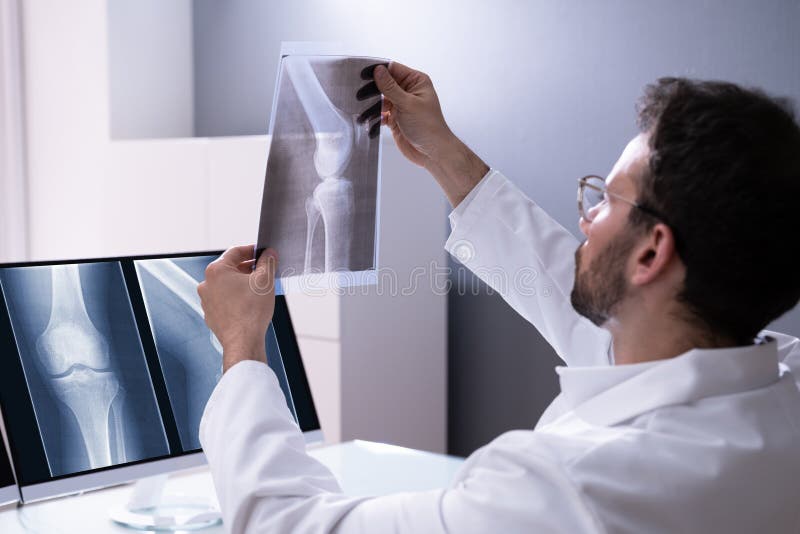 Doctor Screening Knee Bone X Ray Stock Photo - Image of computer ...
