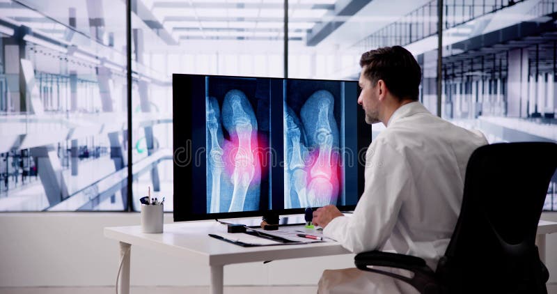 Doctor Screening Knee Bone X Ray Stock Photo - Image of surgeon, scan ...