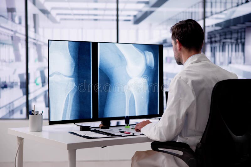 Doctor Screening Shoulder MRT Scan Stock Photo - Image of mature, scan ...