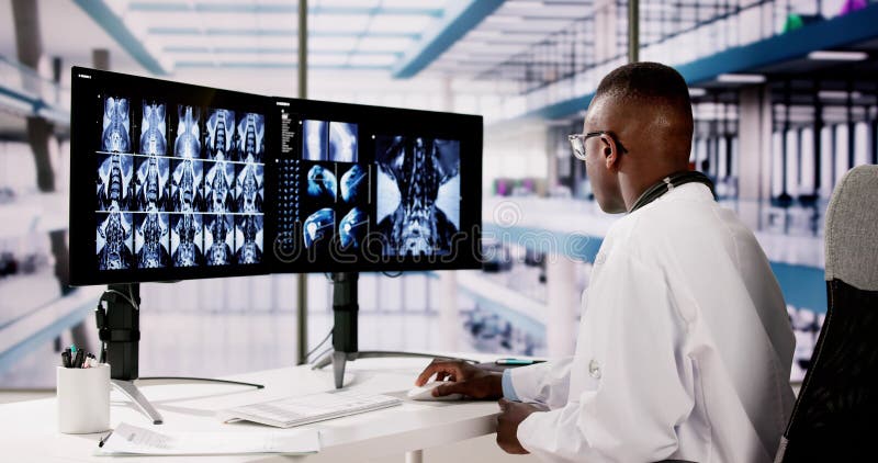 Doctor Screening Knee Bone X Ray Stock Photo - Image of resonance ...