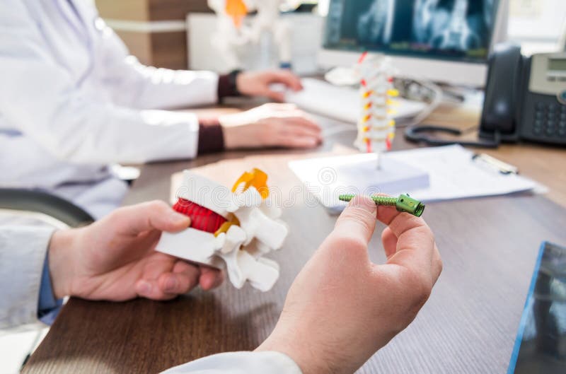 Doctor Show Polyaxial on the Spine Model. Spine Fixation Systems Stock ...