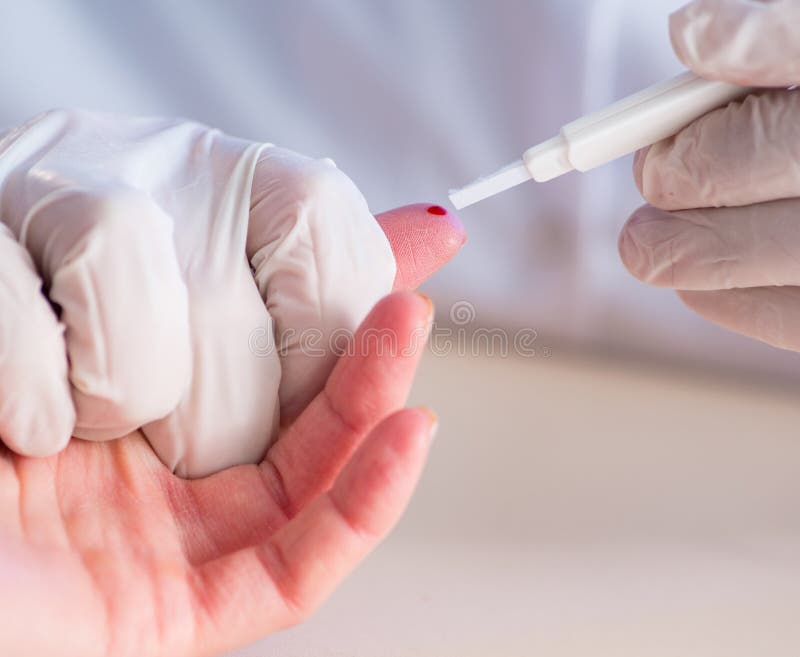 Doctor Taking Blood Samples from Finger Stock Photo - Image of donate ...