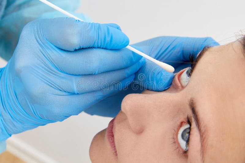 Doctor Taking Sample with Swab from the Eye Stock Photo - Image of ...