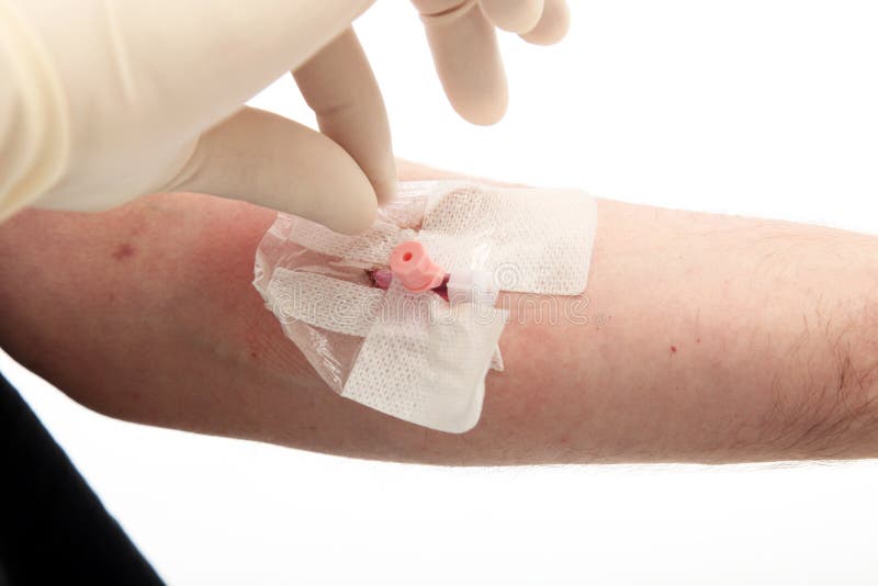 Doctor Taping a Needle into a Vein Stock Image - Image of male ...