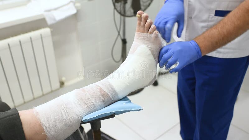 Doctor Traumatologist Puts a Plaster on the Broken Leg of the Patient ...