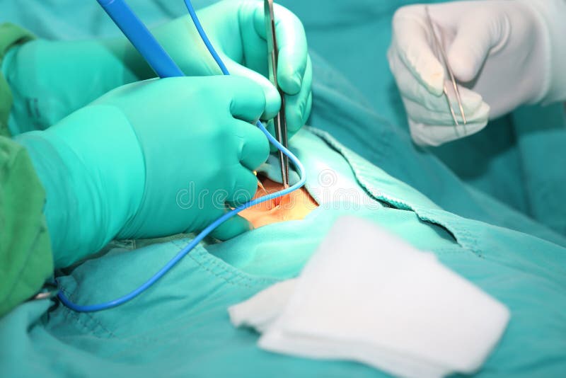 Doctor Using an Electronic Scalpel in a Surgery Stock Photo - Image of ...