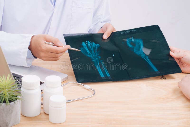 Doctor and Woman Patient Looking X-ray Scan Stock Photo - Image of rays ...