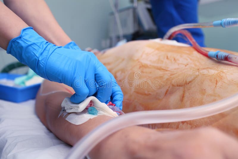 Doctor Work with Patient in Intensive Care after Surgery Stock Image ...