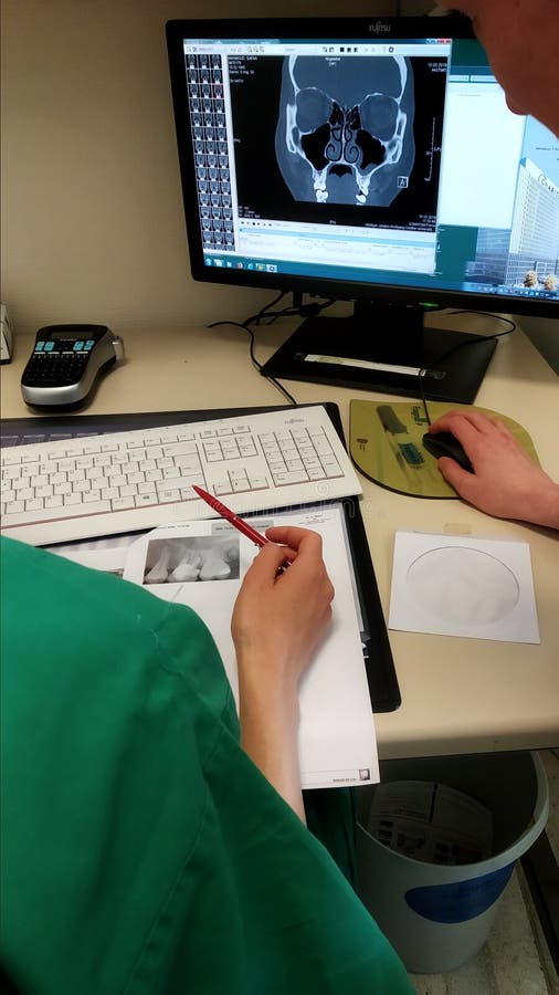 Doctors Checking MRI on on the Screen Editorial Stock Photo - Image of ...