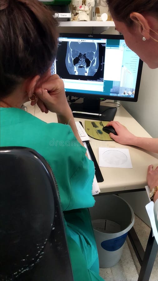 Doctors Checking MRI on on the Screen Editorial Image - Image of ...