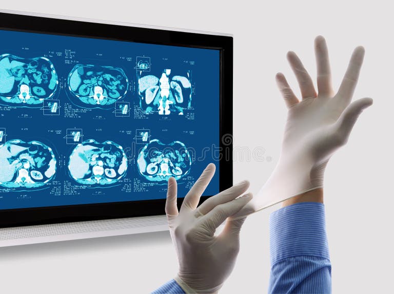 Doctors Hands with MRT Screen Stock Image - Image of help, surge: 23009919