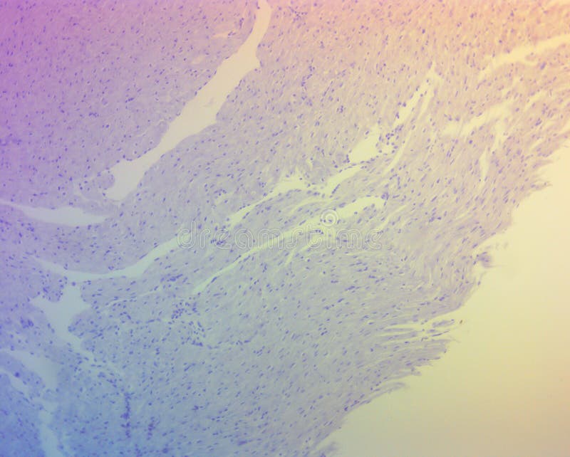 Dog cardiac muscle stock image. Image of stain, microscopy - 63188099