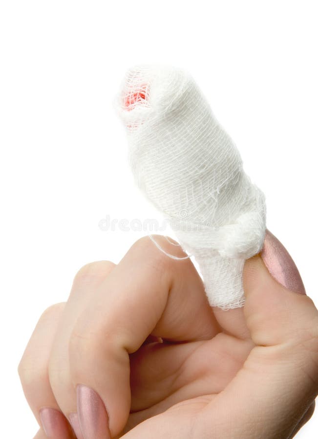 Paronychia, Doigt Gonflé Avec L'inflammation De Lit D'ongle Due à L ...