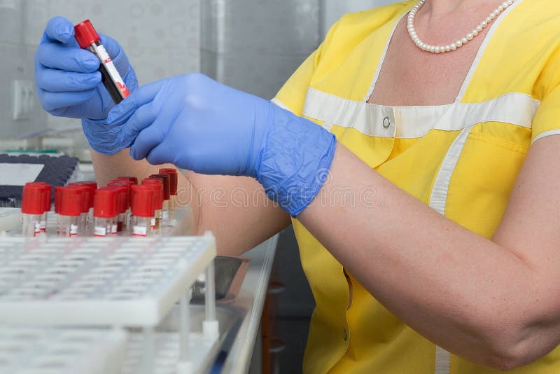 Medical blood test. stock image. Image of tube, test - 238544621