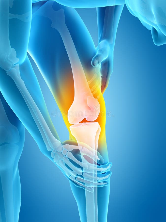 Dolor de la rodilla stock de ilustración. Ilustración de rodilla - 74188006