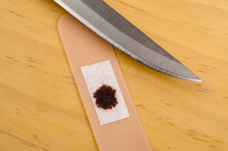 Domestic accident stock image. Image of hurt, dangerous - 71600525