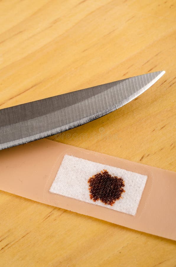 Domestic accident stock photo. Image of band, shot, bandaid - 71600624