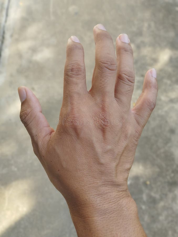 Dorsum of hand stock image. Image of gemstone, architecture - 256516989