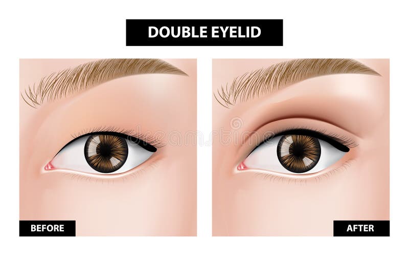 Double Eyelid Stock Illustrations – 101 Double Eyelid Stock ...