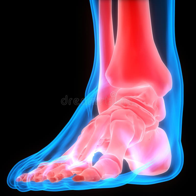 Douleurs Osseuses Communes De Corps Humain Illustration Stock ...