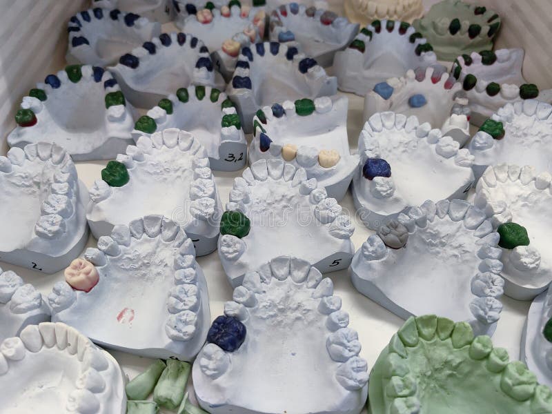 A Dozen Models of Artificial Denture of Human Teeth Stock Image - Image ...