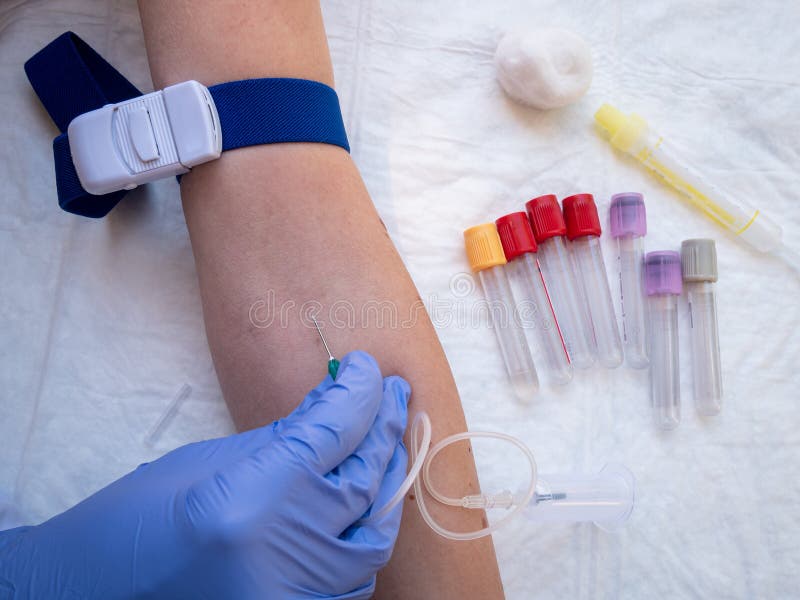 Drawing blood stock image. Image of people, exam, analysis - 181097683