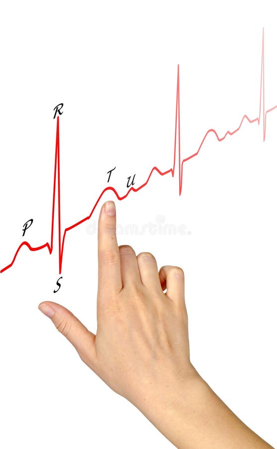 Drawing ECG stock image. Image of hand, presenting, electrocardiogram ...