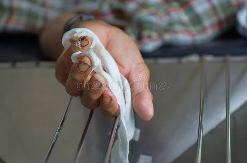 DRessing fingers wound. stock photo. Image of hand, wound - 82479746