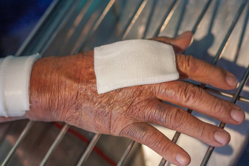 Dressing hand wound stock image. Image of medicine, care - 115487703