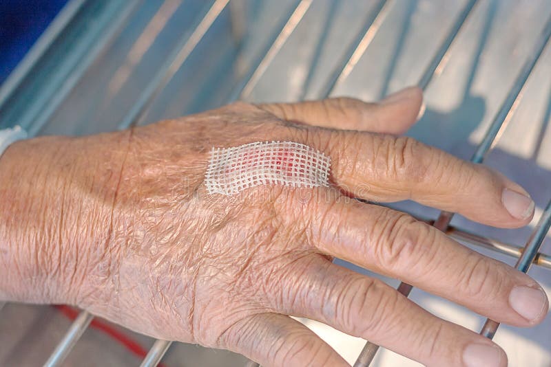 Dressing hand wound stock photo. Image of closeup, woundtreatment ...