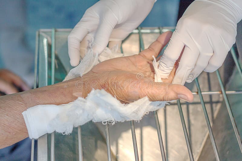 Dressing hand wound stock photo. Image of nurse, wounded - 115183104