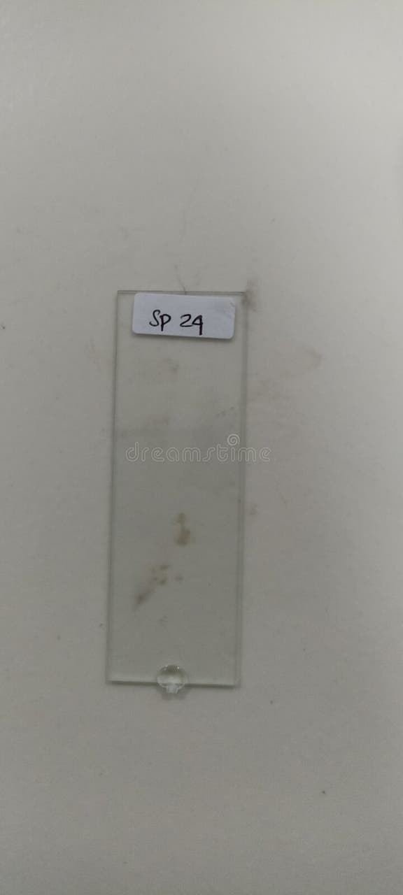 Dried fish otoliths stock photo. Image of ggari, otoliths - 261786550