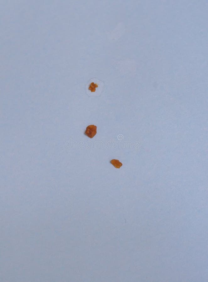 Tonsil Anatomy Stock Photos - Free & Royalty-Free Stock Photos from ...