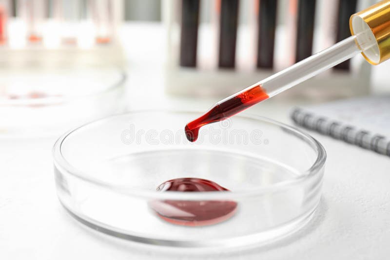 Dripping Blood from Pipette into Petri Dish on Table, Closeup ...