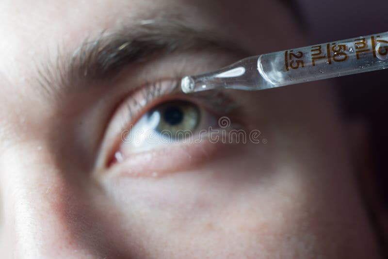 Dripping Drops into the Eye with a Pipette, Close-up Stock Photo ...