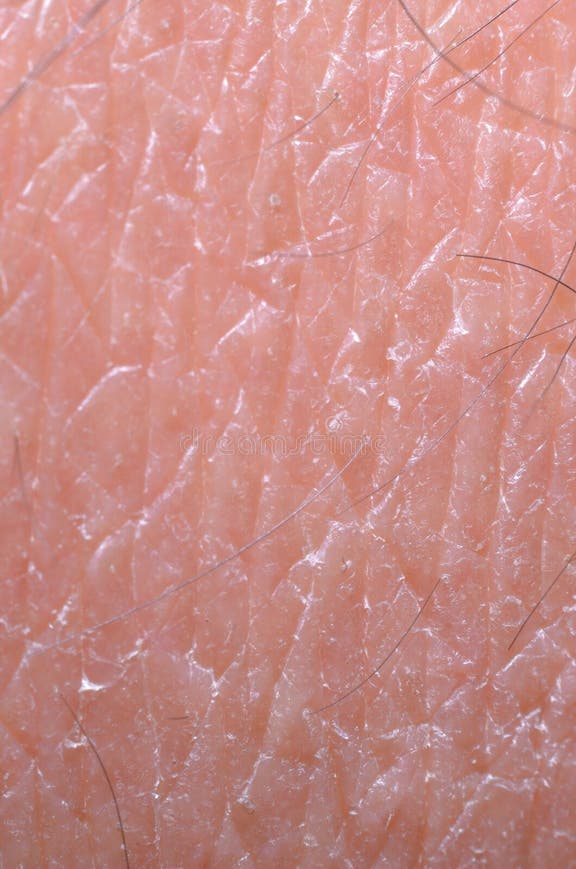 Droge huid stock afbeelding. Image of vlek, teint, menselijk - 34808005