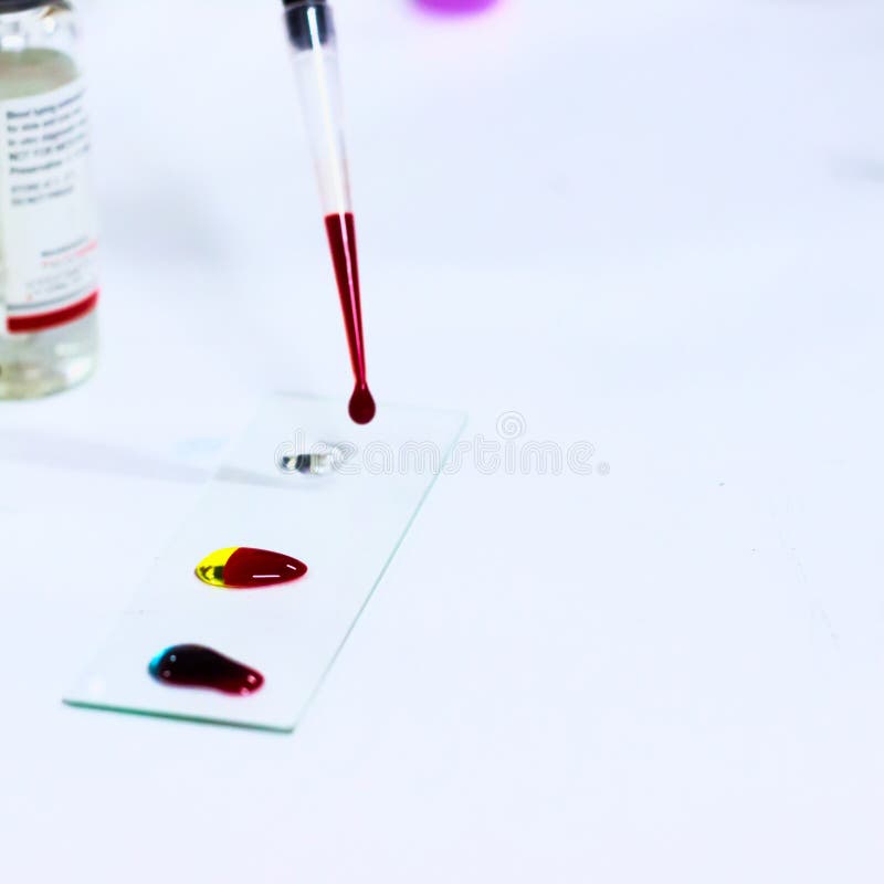 Drop of Blood on Glass Slide for Blood Grouping Using Micro Tip Stock ...