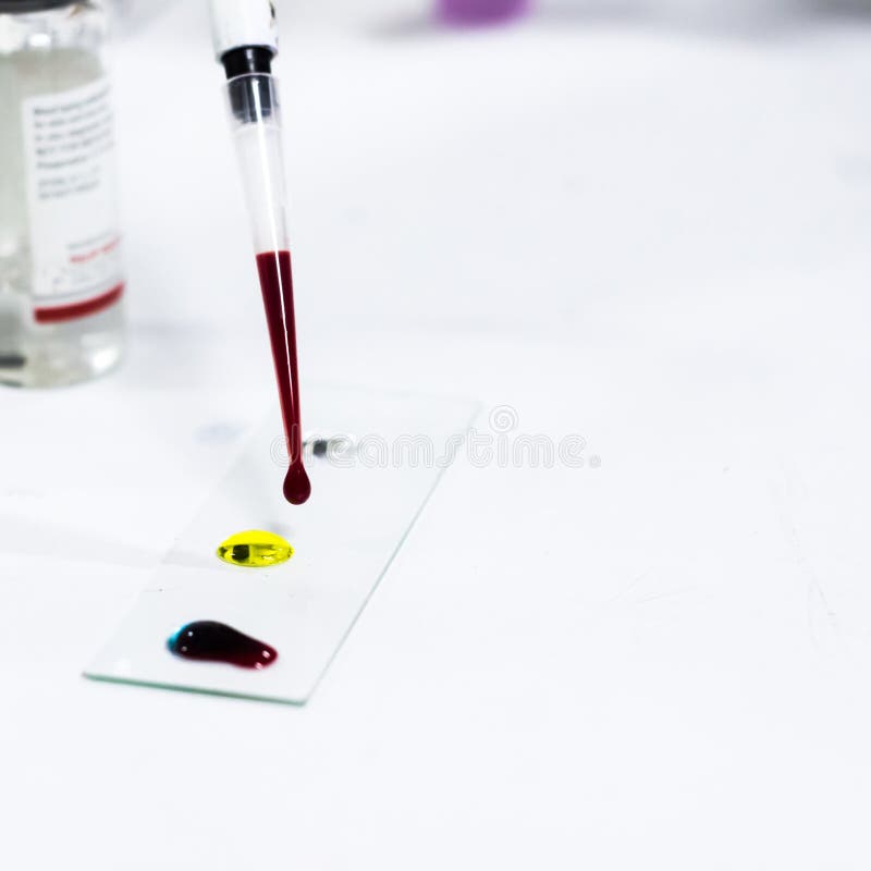 Drop of Blood on Glass Slide for Blood Grouping Using Micro Tip Stock ...