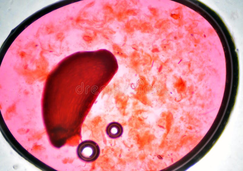 Raspberry Under Microscope Stock Photos - Free & Royalty-Free Stock ...