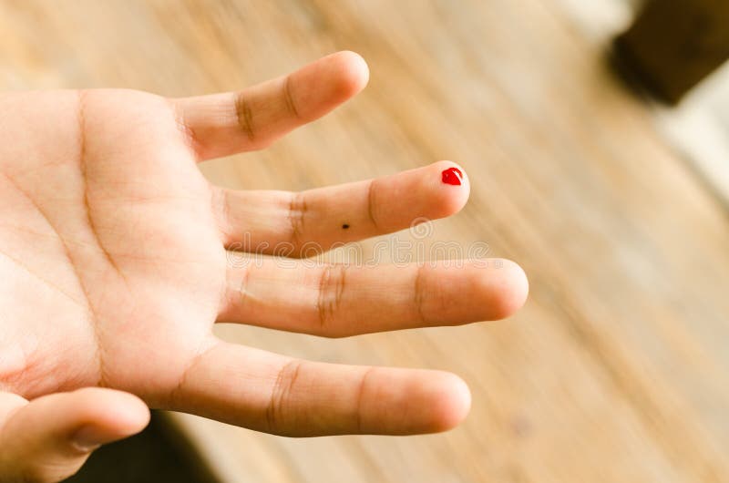 Drop of Red Blood from Finger for Test Stock Photo - Image of drop ...