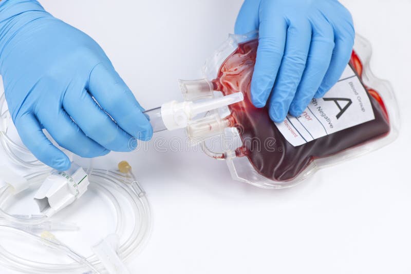 Blodtransfusion arkivfoto. Bild av vetenskap, grupp, vetenskapligt ...