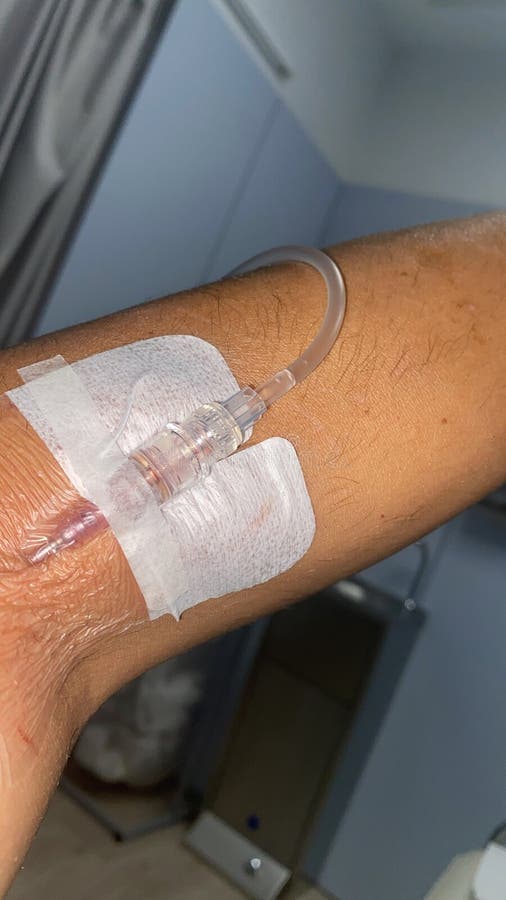 Dropper Needle in a Left Arm in a Hospital Stock Photo - Image of vein ...