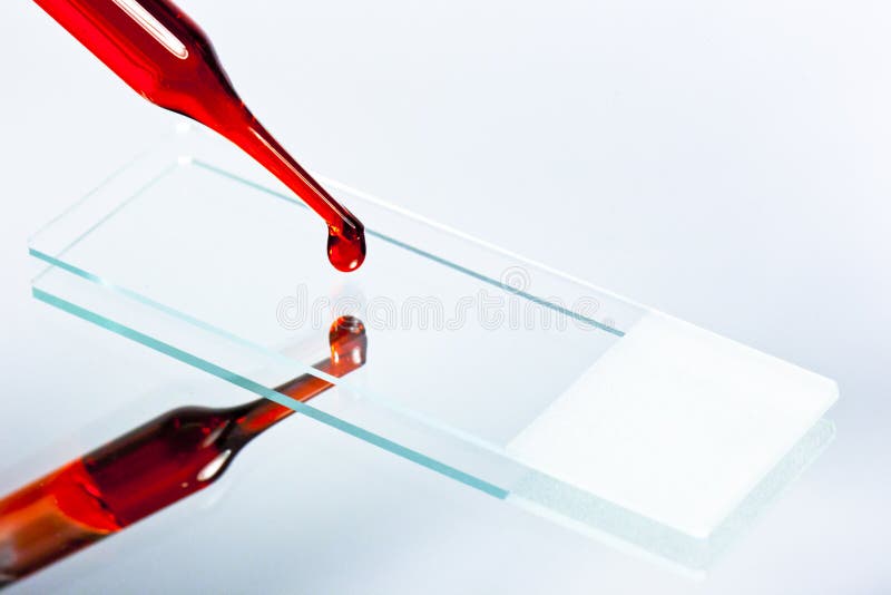 Dropping Blood Onto Microscope Slide 1 Stock Image - Image of test ...