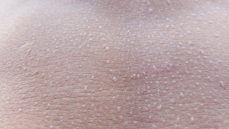 Drops of sweat on the skin stock image. Image of female - 124457445