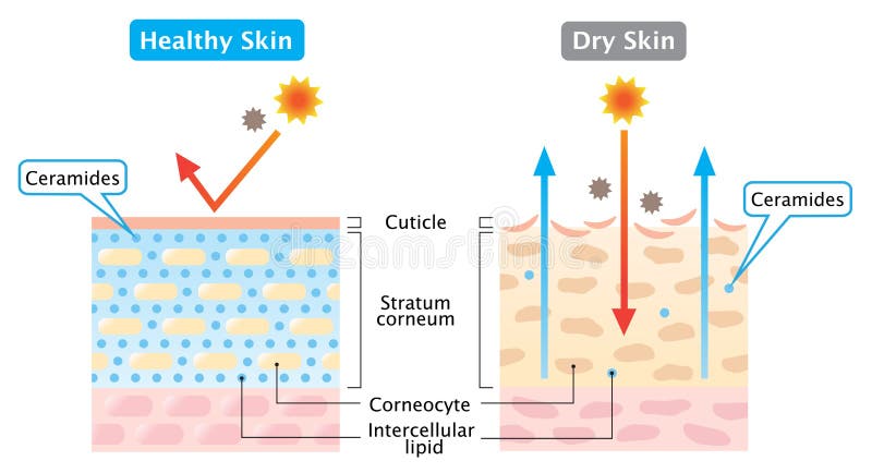 Healthy Skin And Dry Skin Diagram Structure Of Stratum Corneum And