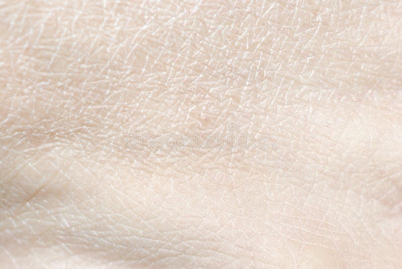 Dry skin texture stock image. Image of eczema, dermatitis - 18622837