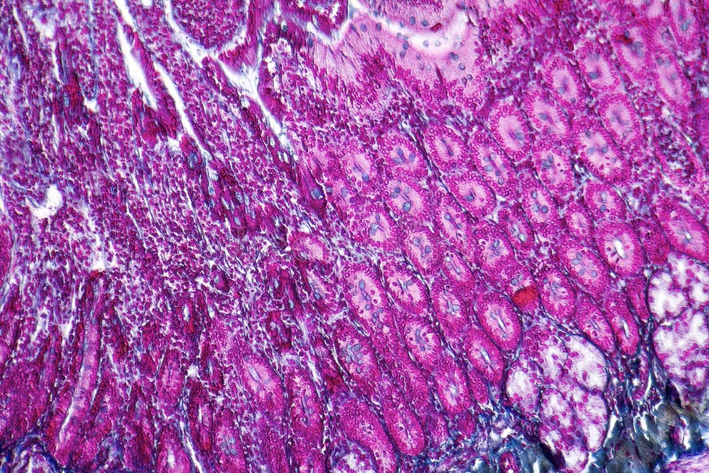 Duodenum cross section stock photo. Image of intestine - 83130796