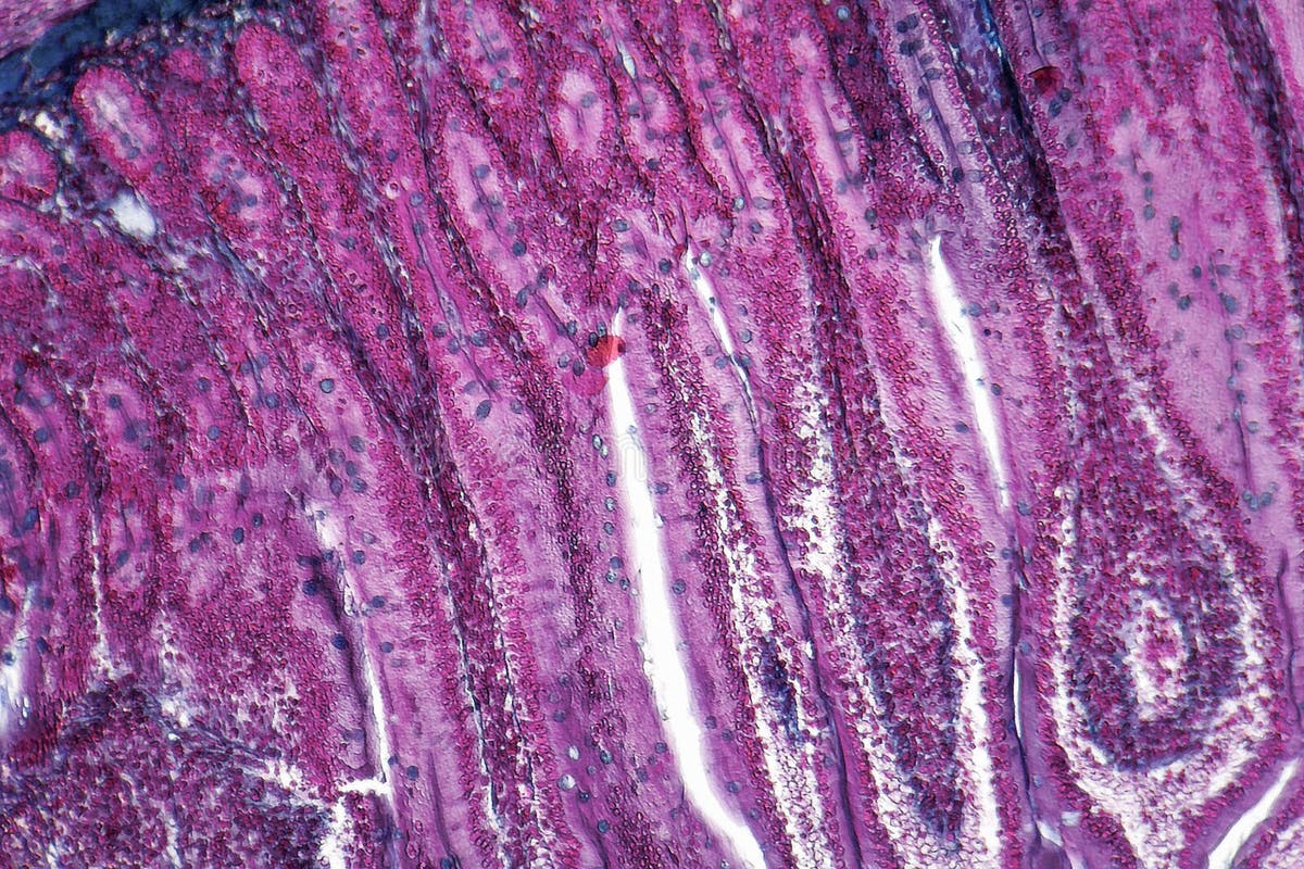 Anatomy Small Intestine Cut Section Stock Photos - Free & Royalty-Free ...