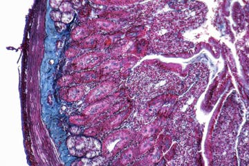 Anatomy Small Intestine Cut Section Stock Photos - Free & Royalty-Free ...